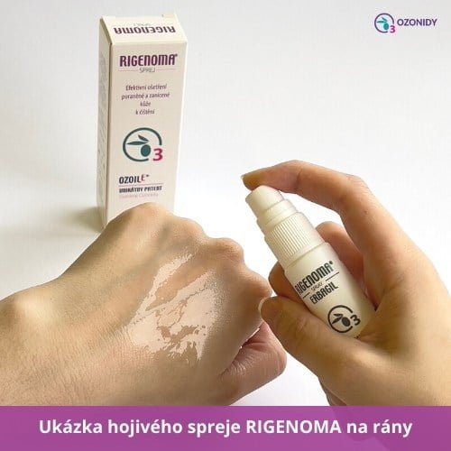 RIGENOMA sprej (NOVINKA) | Rigenoma.cz